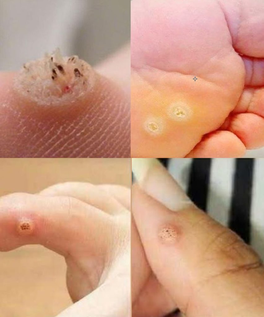 How to Spot Concerning Moles and Protect Your Skin Health – DecoRafit